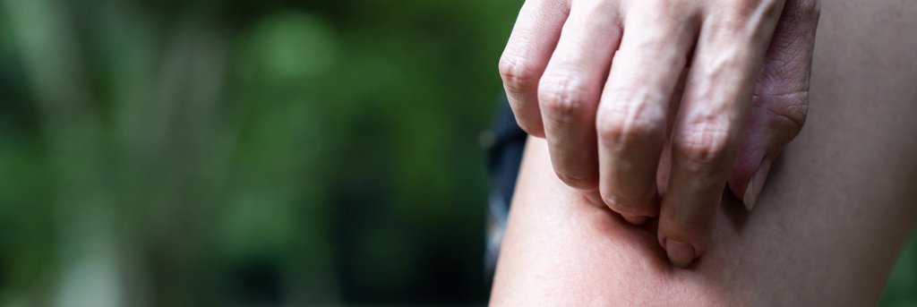 Scientific reason some people get bitten by mosquitos more than others