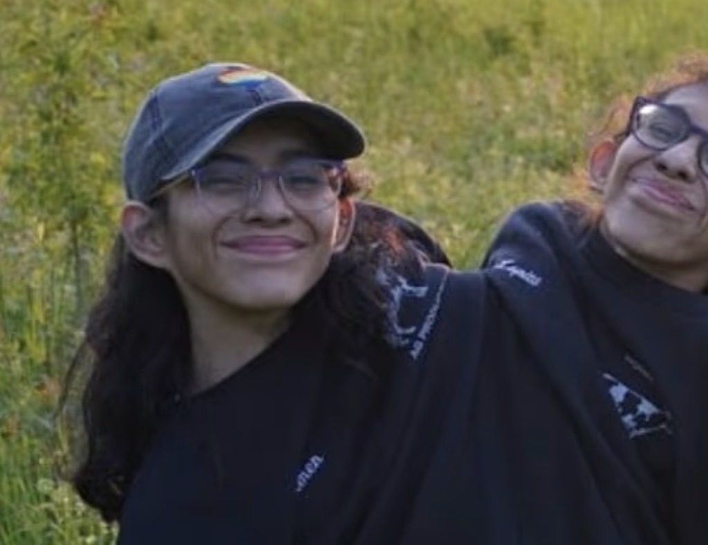 Conjoined twins reveal what would happen if one of them died