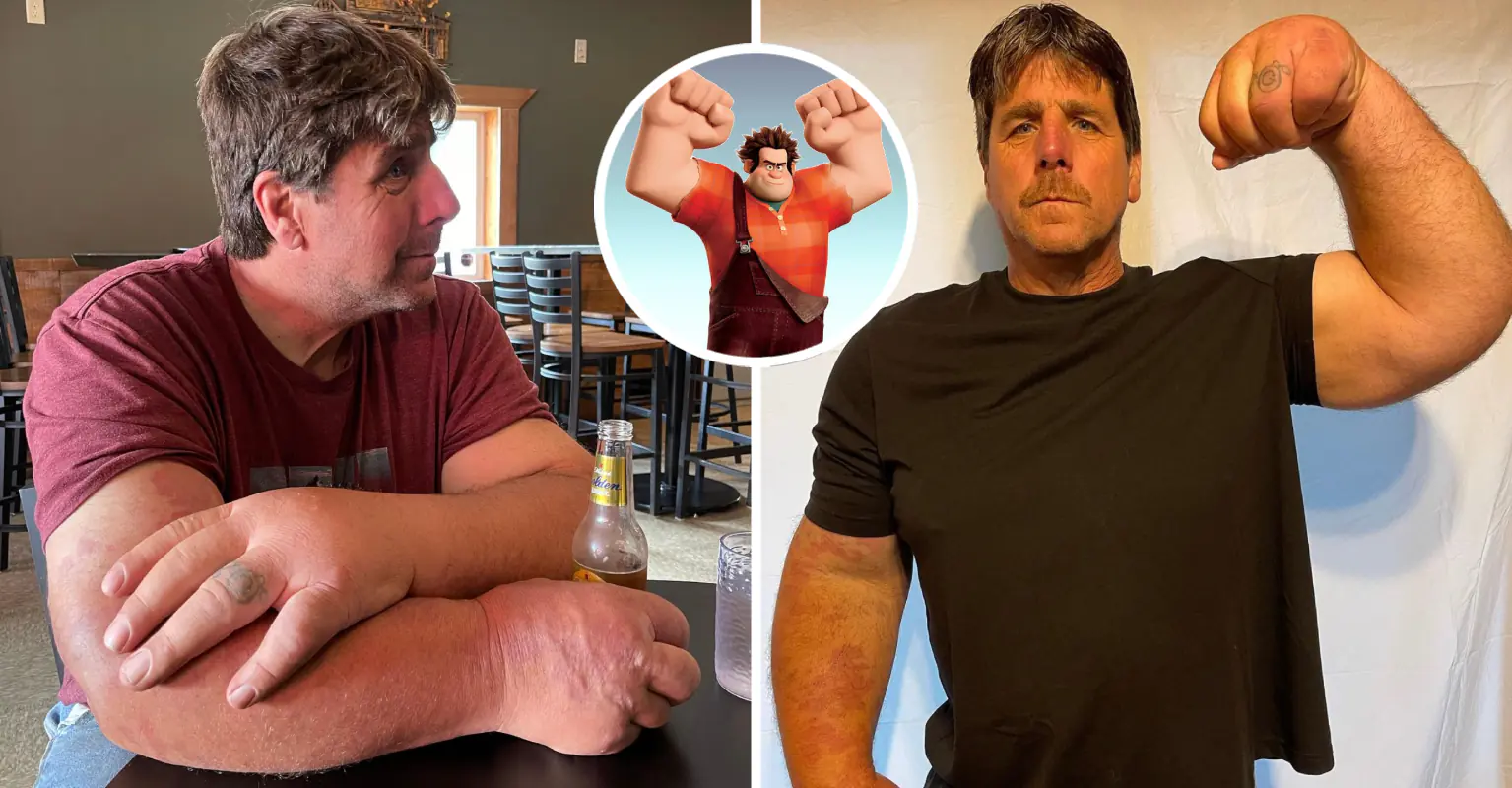 Real-Life 'Wreck-It Ralph' Wows Social Media With His Incredible ...