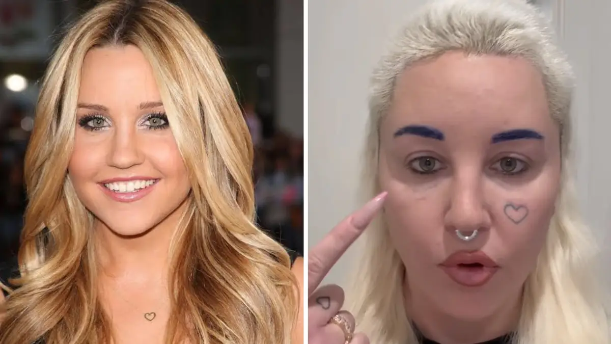 Amanda Bynes confirms she had plastic surgery after fans question ...